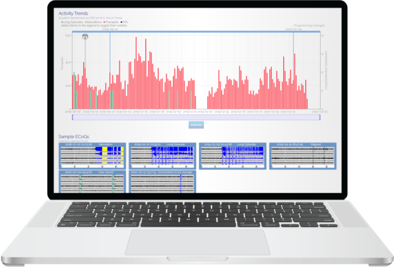 The RNS System | Personalized Neuromodulation Therapy